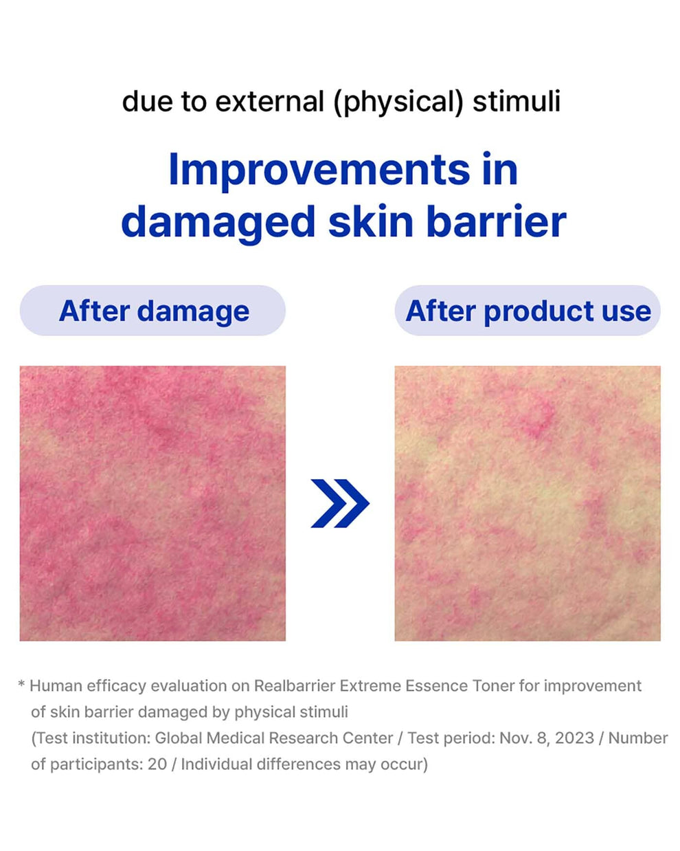 Real Barrier Essence Toner Original | Soko Glam