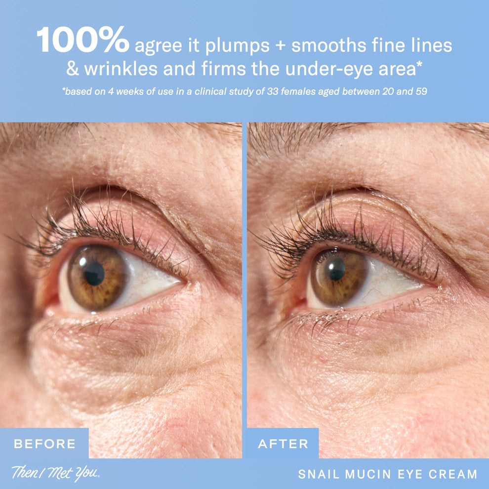 Then I Met You Snail Mucin Eye Cream | Soko Glam