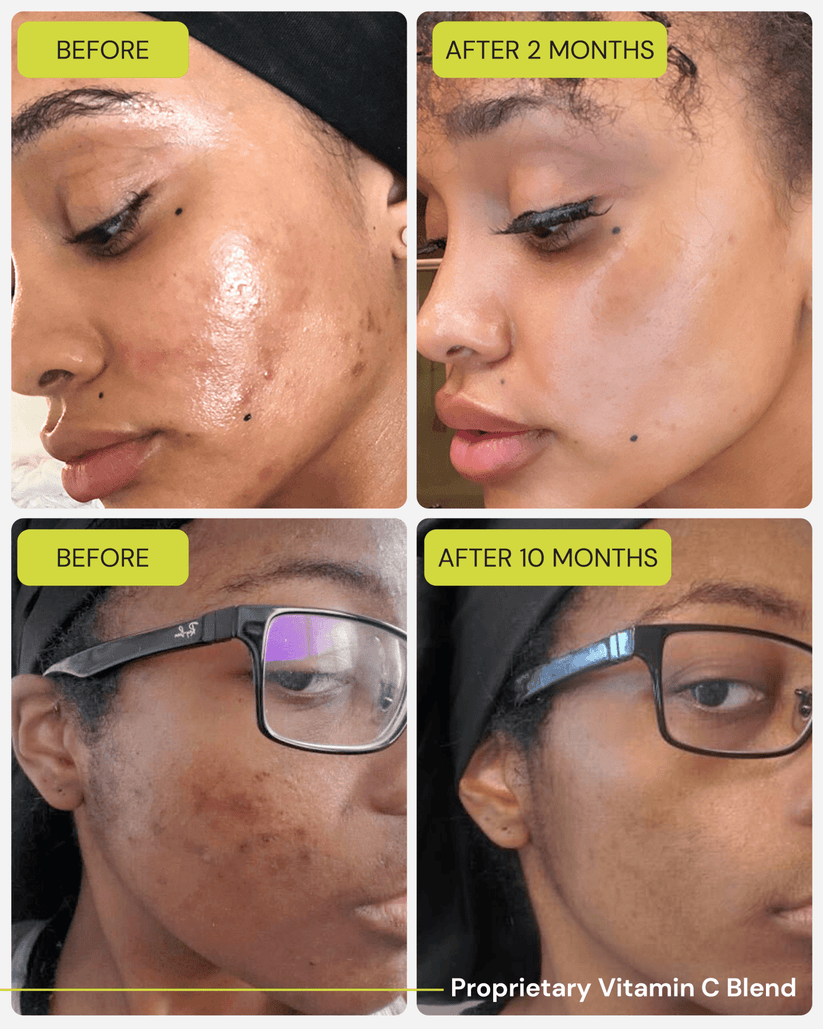 Gleamin Vitamin C Treatment Mask w/ Brush | Soko Glam